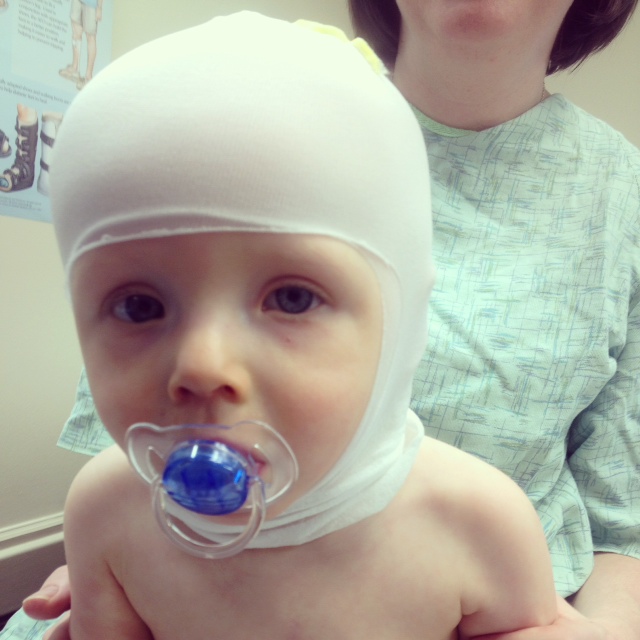 Cranial Interfaces | Orthotics | Paceline